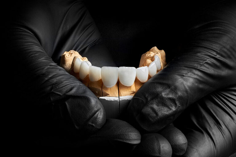 Exploring Tooth Covering Options: How Porcelain Veneers Enhance Your ...